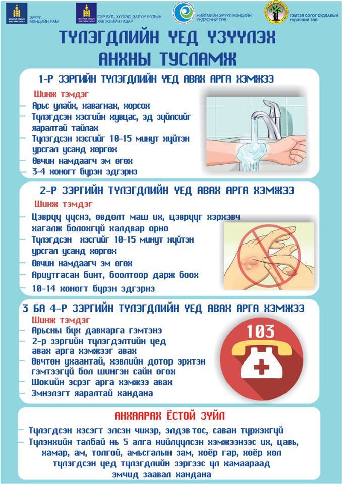 Түлэгдлийн үед үзүүлэх анхны тусламж News Mn