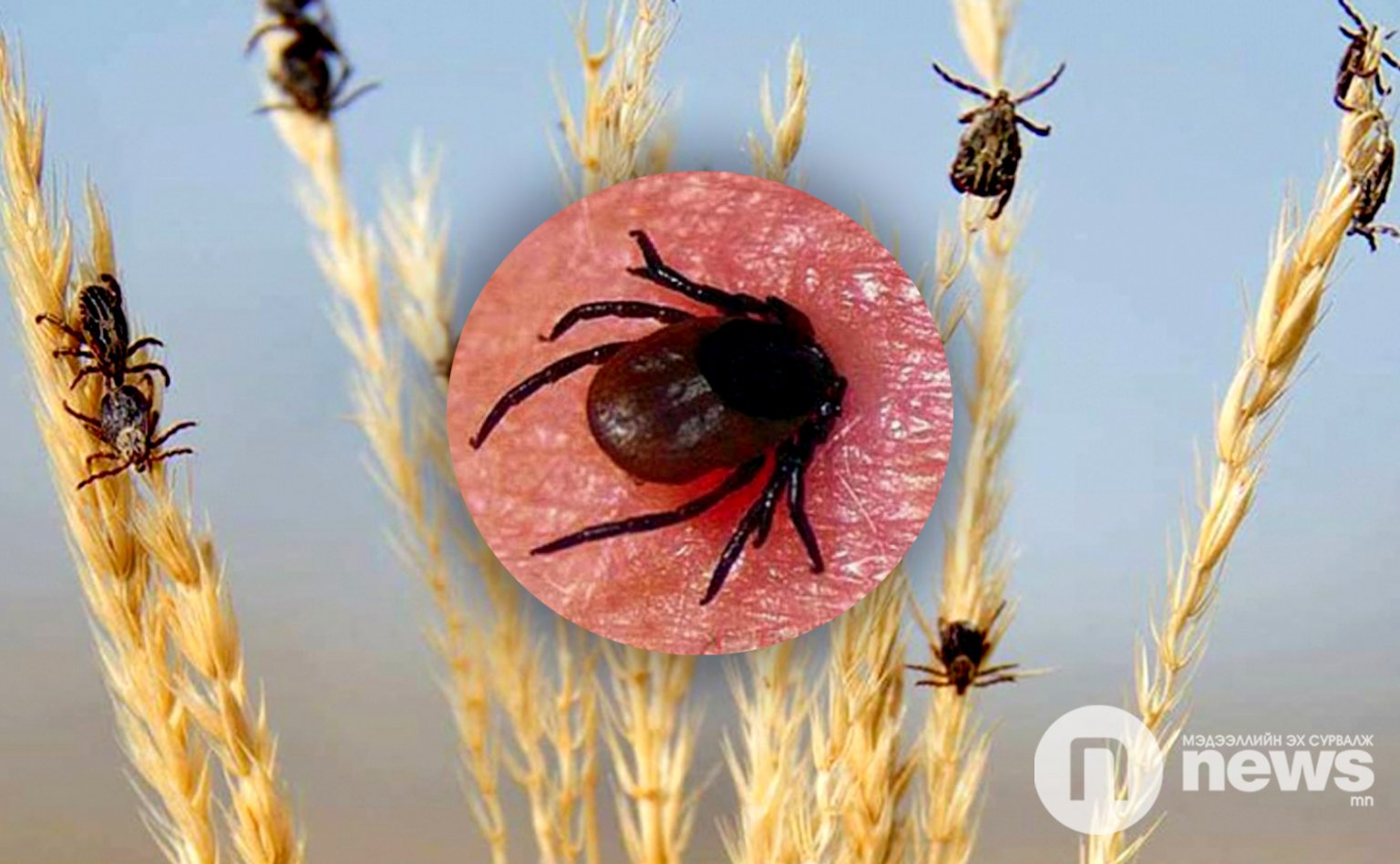 “Хачигт халдварын 40 гаруй тохиолдол бүртгэгдсэн” News Mn
